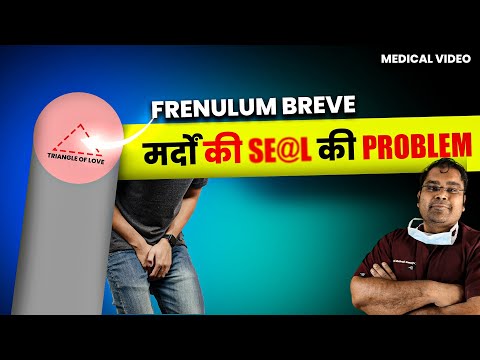 दर्द और जल्दी झड़ना | Frenulum Problem of Men