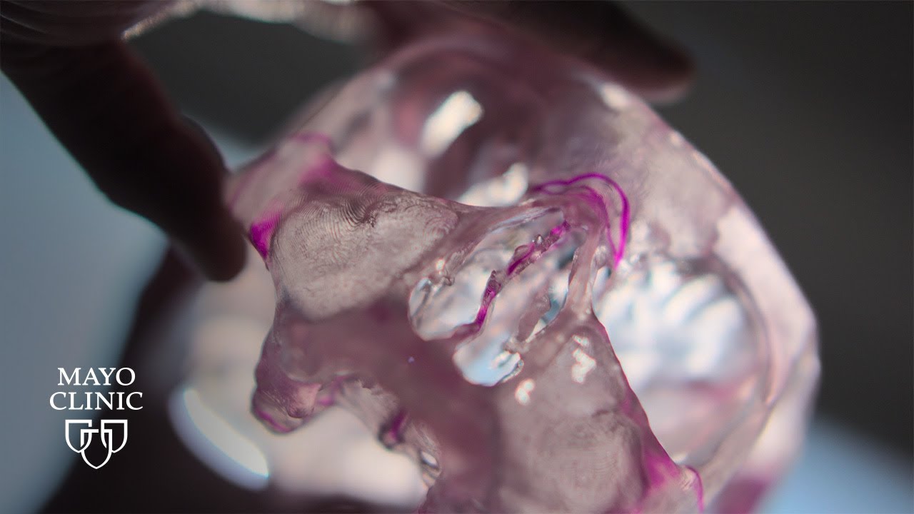 One Breakthrough Facial Surgery Gives Hope and a Second Chance - YouTube