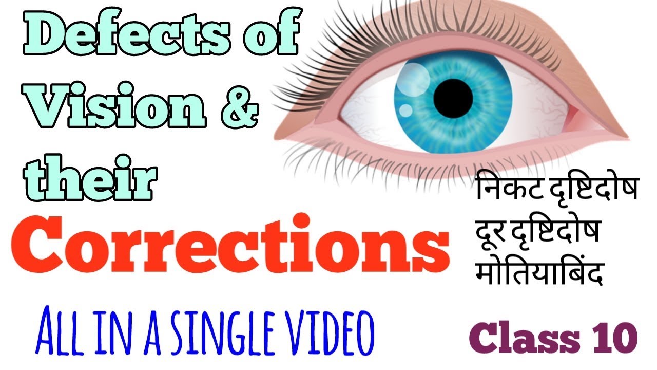 Mindmap Of Vision Defects | Defects Of Vision and their corrections ...
