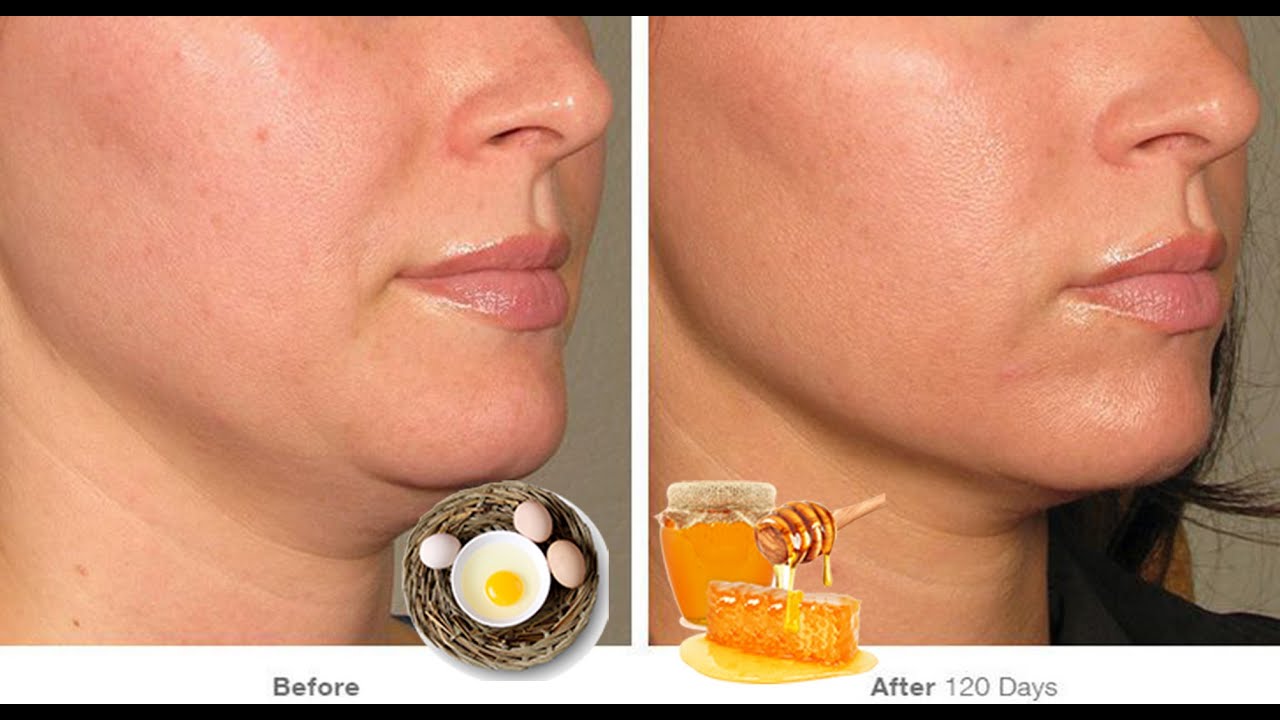 DIY Facial Mask for Excess Skin | No weight loss surgery required - YouTube