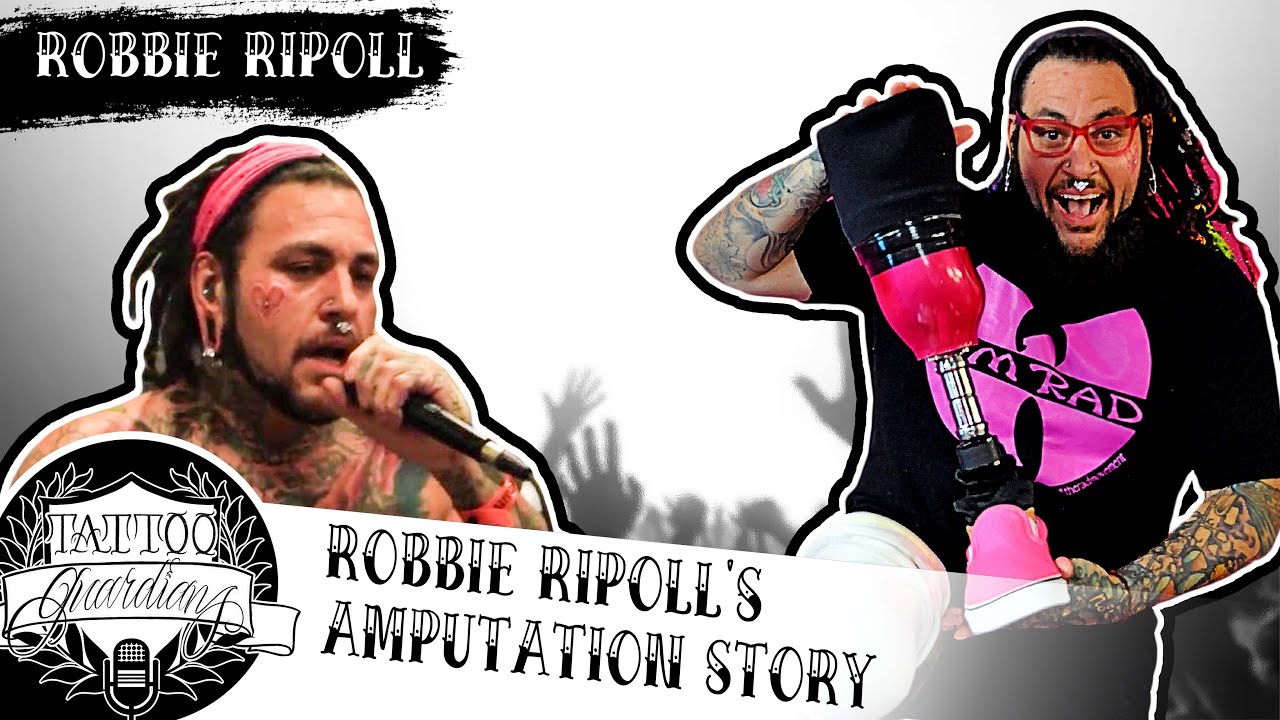 Robbie Ripoll's Amputation story - YouTube