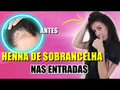 COMO DISFARÇAR ENTRADAS E FALHAS NO CABELO, SERVE PARA QUEM TEM ...
