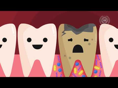 Developmental Dental Anomalies - Shape, Size and Number of Teeth - YouTube
