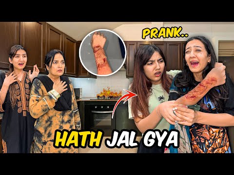 Dangerous burn Prank with my family 😱 Mera Hath Jal Gya 😭| Mama Naraz Hogyein 😭| Sistrology