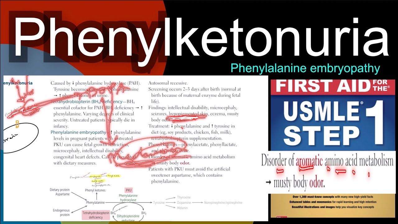 Phenylketonuria, BH4 deficiency Phenylalanine embryopathy in Hindi/Urdu ...