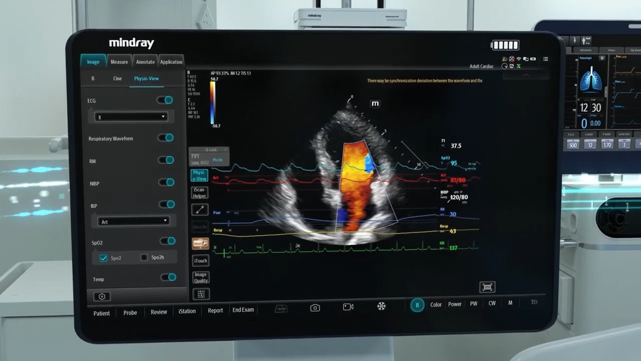 TEX20 Mindray | Sistema de ultrasonido para diagnóstico - YouTube