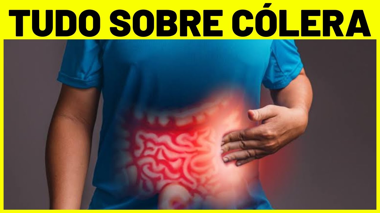 CÓLERA - O QUE É, CAUSAS, SINTOMAS E TRATAMENTO - YouTube