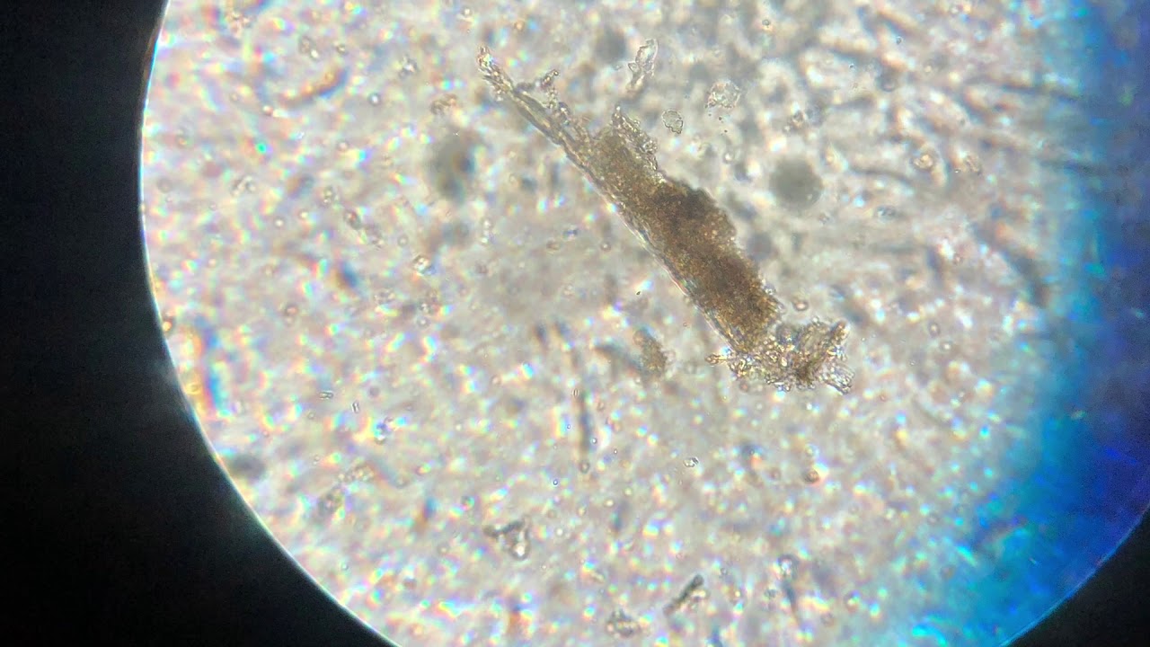 Aerated compost tea microscopy - YouTube