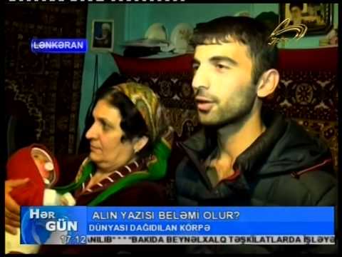 ATILMIS USAQ