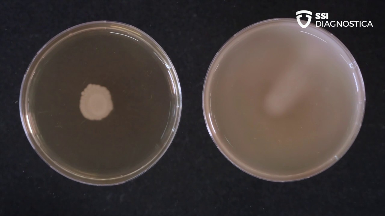 Salmonella Phase Inversion - YouTube