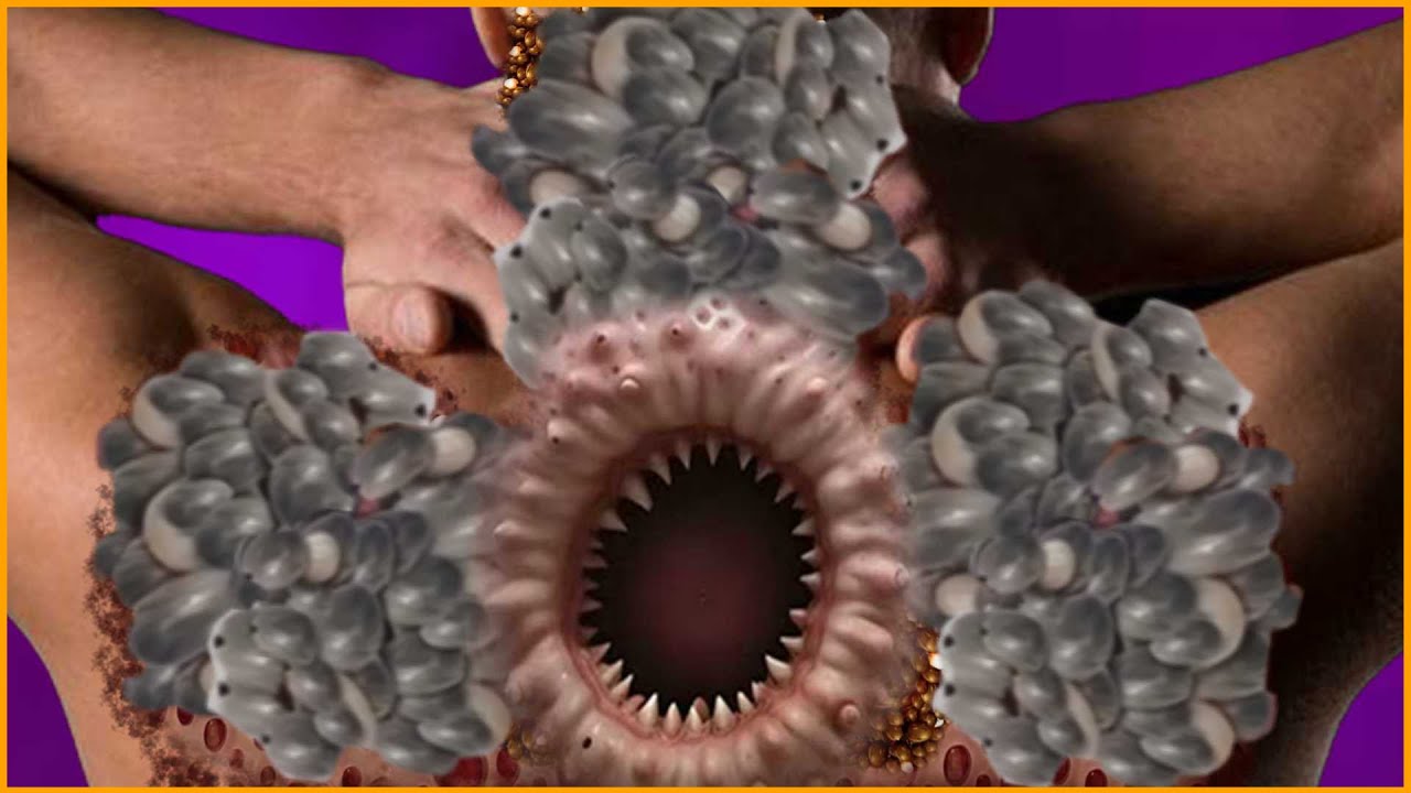 ASMR neck got worms | Man got back worms - YouTube