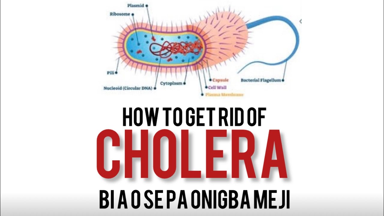 Essential Tips: How to Get Rid of Cholera and Prevent it’s Spread - YouTube