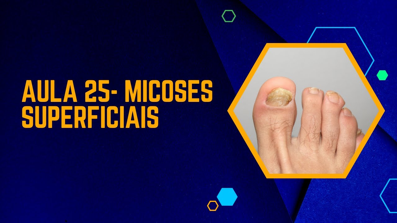 Aula 25 - Micoses Superficiais - YouTube