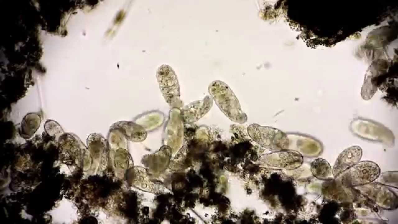 Mikroorganismen - microorganisms - Leben im Wassertropfen - life in a drop under microscope ...
