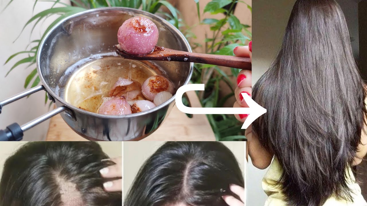 I tried this and my hair growth got doubled in 1 month-Increase Hair ...