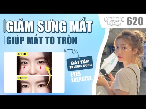 GIÚP MẮT TO & GIẢM SƯNG MẮT | Bài tập Trương Dư Hi | Eyes exercise to improve your vision | Bài 620