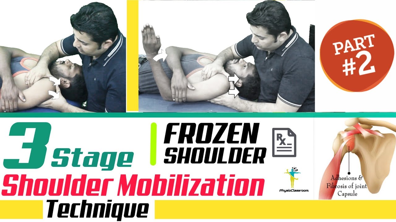 FROZEN SHOULDER TREATMENT : 3 STAGE MOBILIZATION TECHNIQUE (PART-2 ...