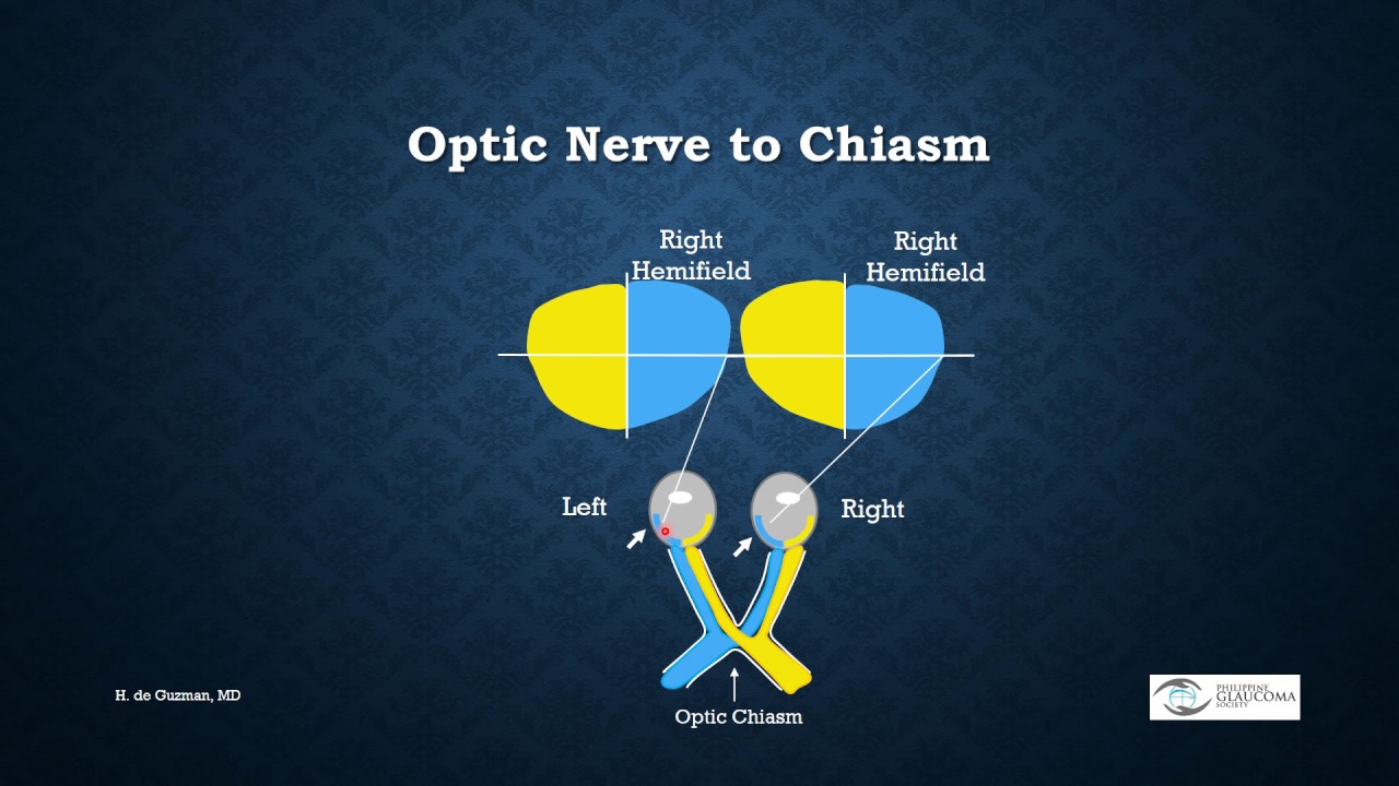 Visual Field - Basics - YouTube