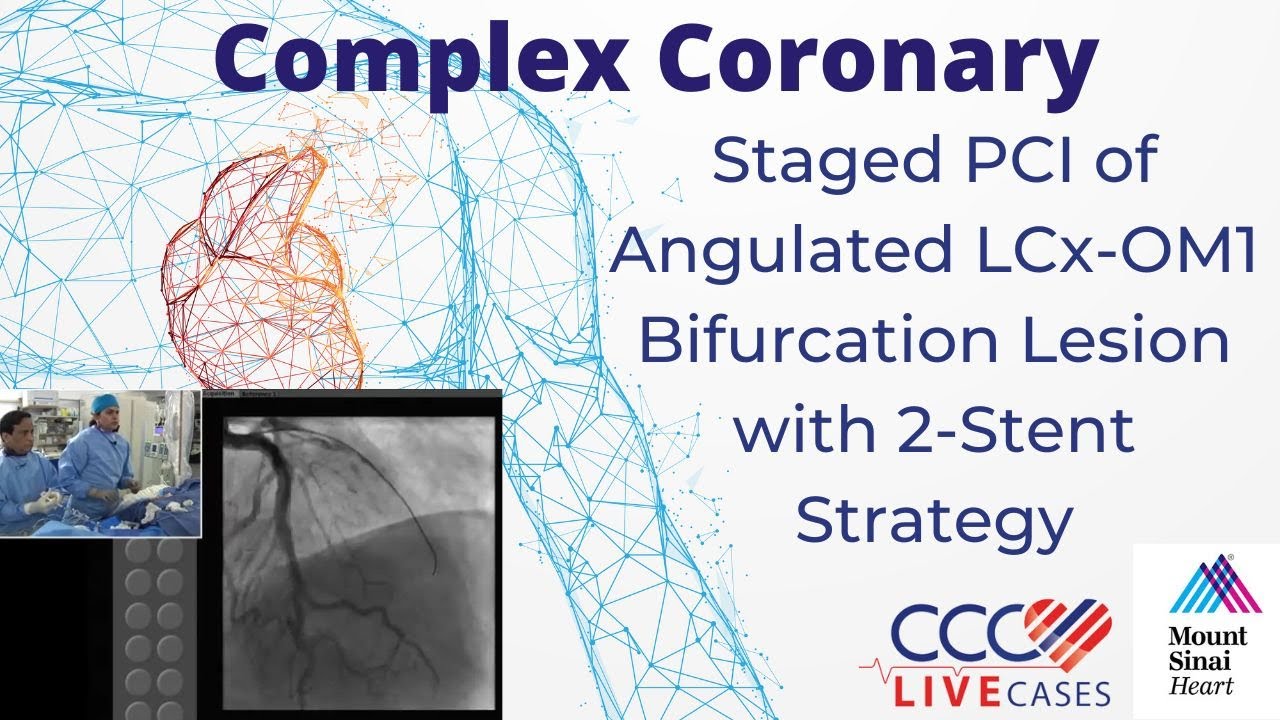 Staged PCI of Angulated LCx-OM1 Bifurcation Lesion with 2-Stent ...