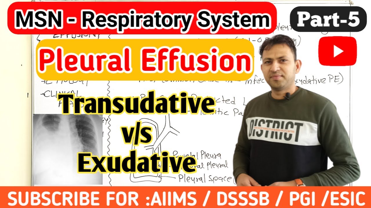 Pleural effusion | transudative vs exudative | causes symptoms ...