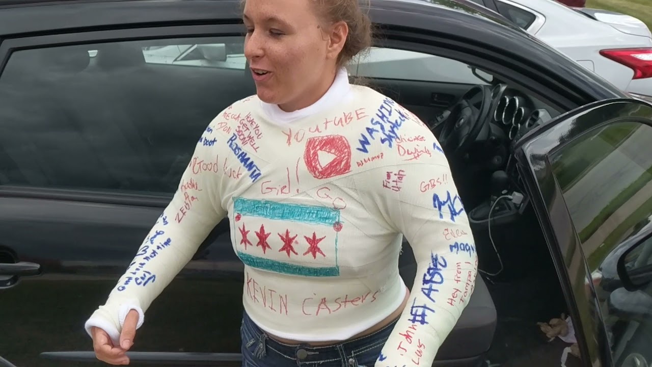 full upper body cast - YouTube