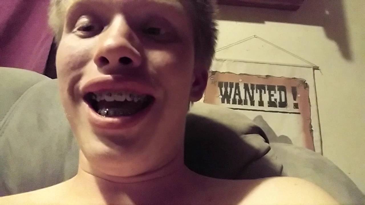 Braces Suck Really Bad Youtube