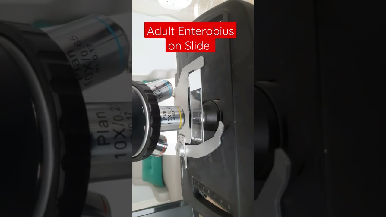 Enterobius Slide