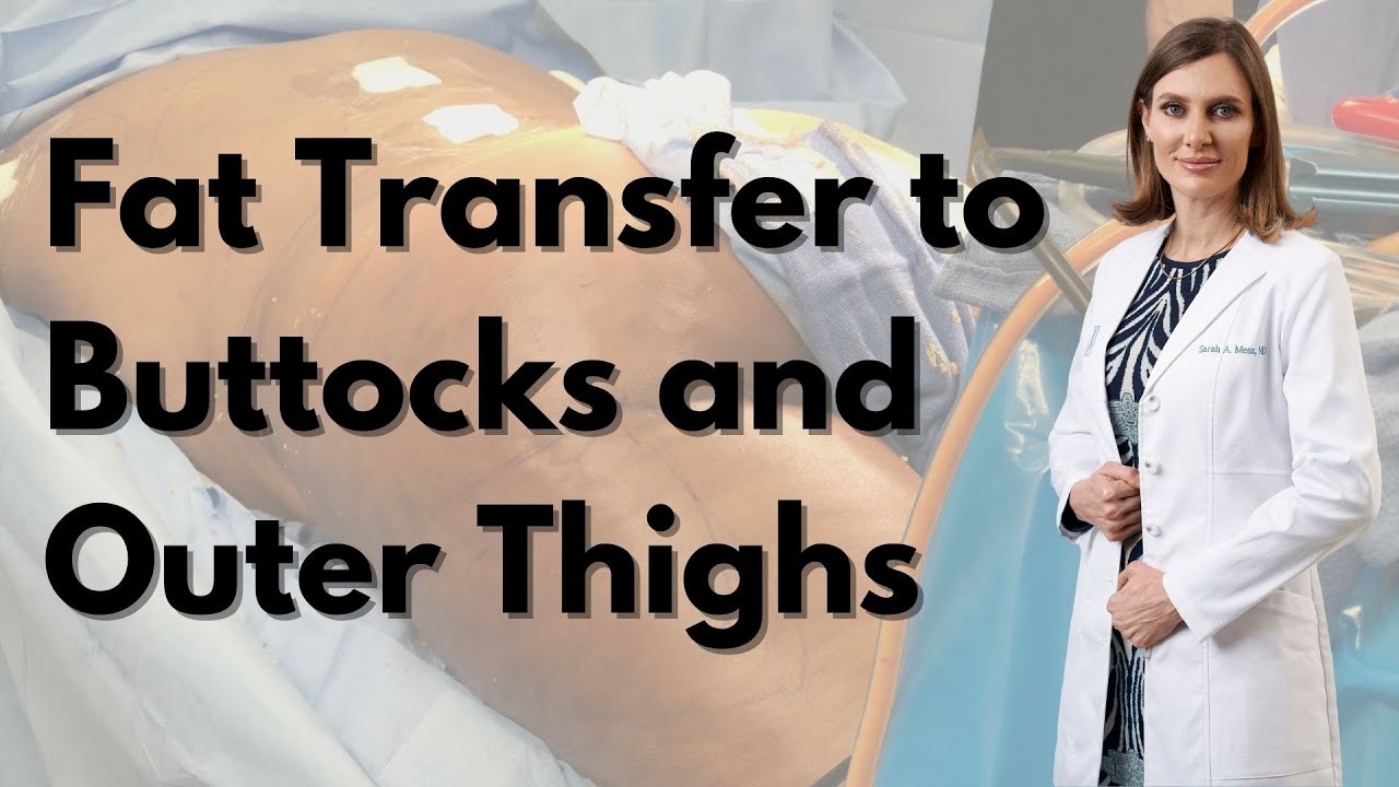 Fat Transfer to Butt & Thighs | Dr. Sarah Mess, Baltimore, MD - YouTube