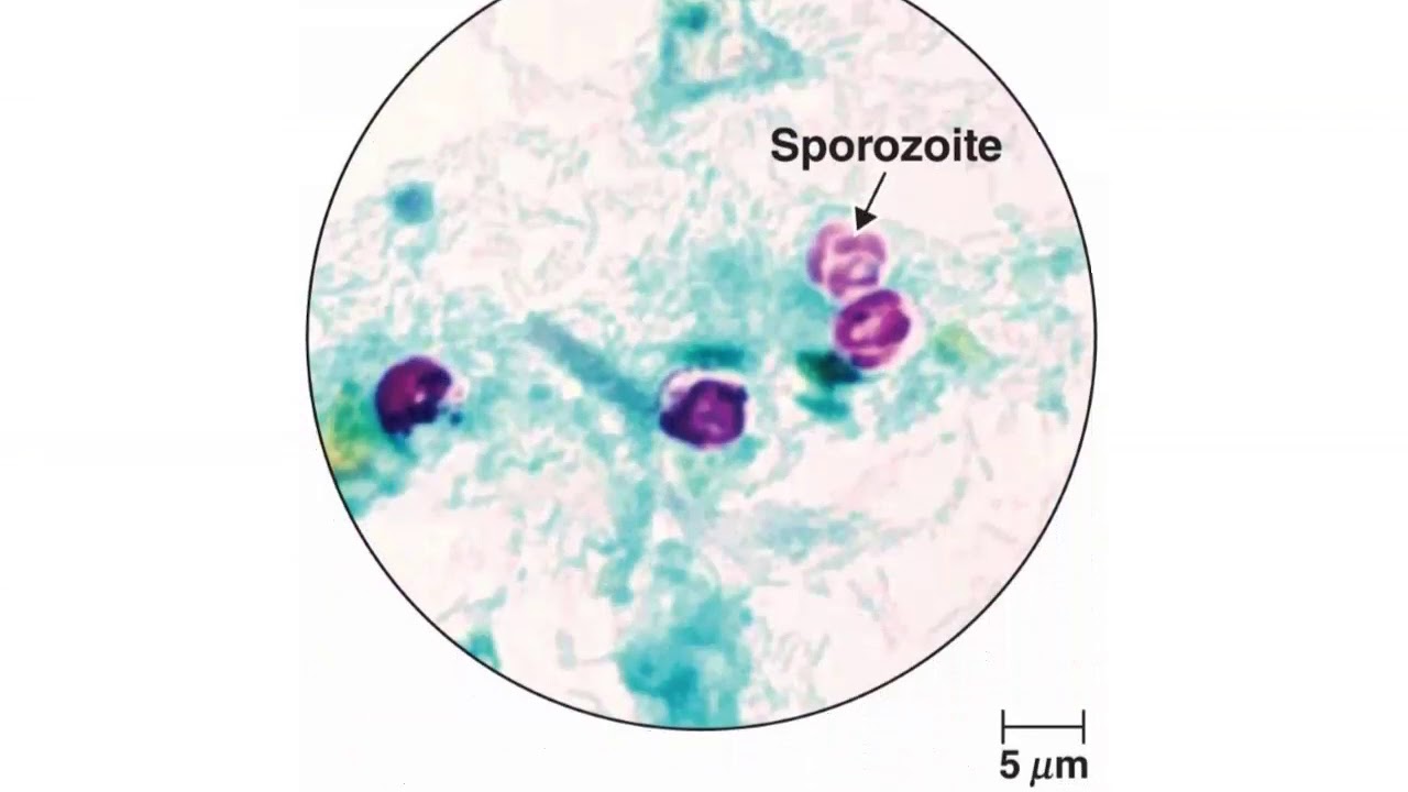 Eukaryotes part 4 - YouTube