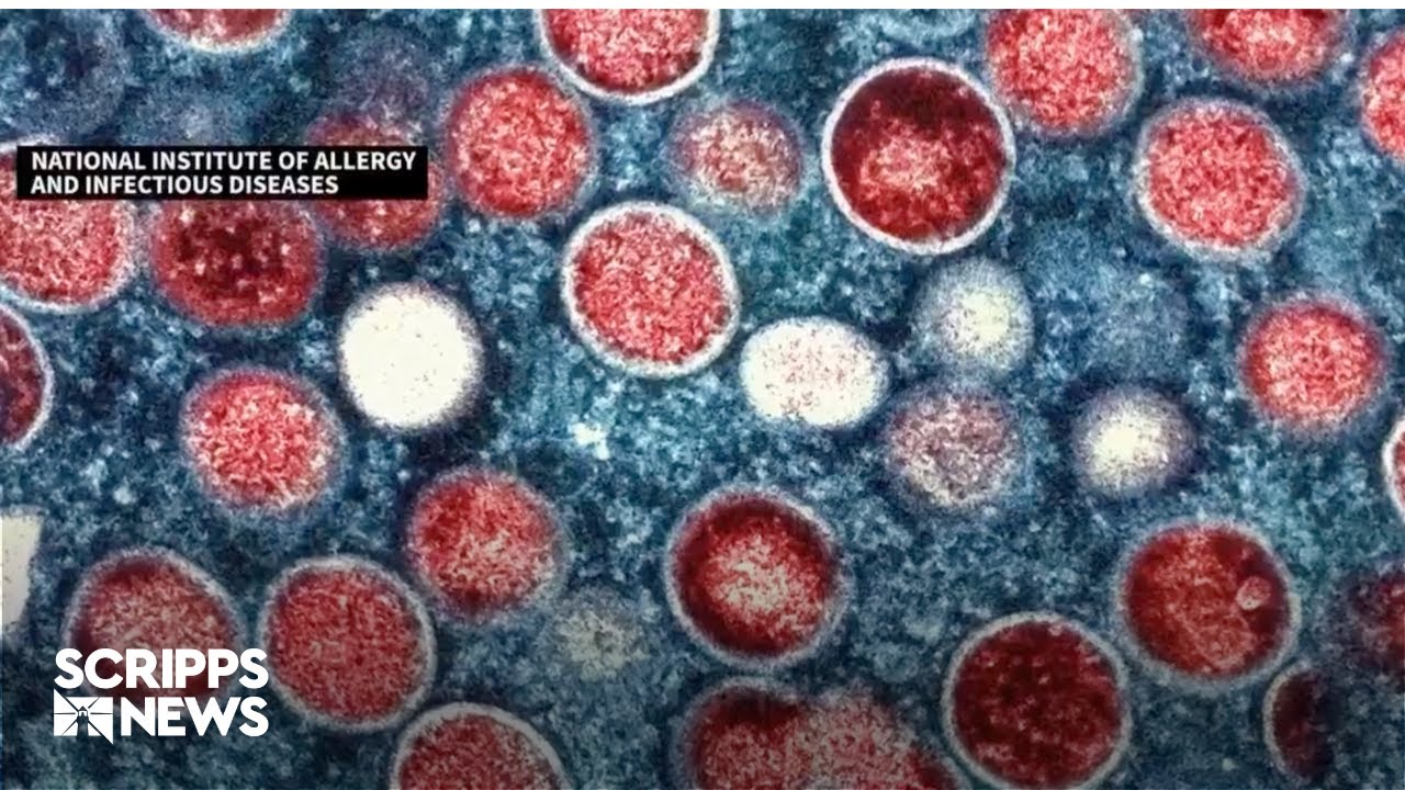 CDC warns of potential mpox resurgence - YouTube
