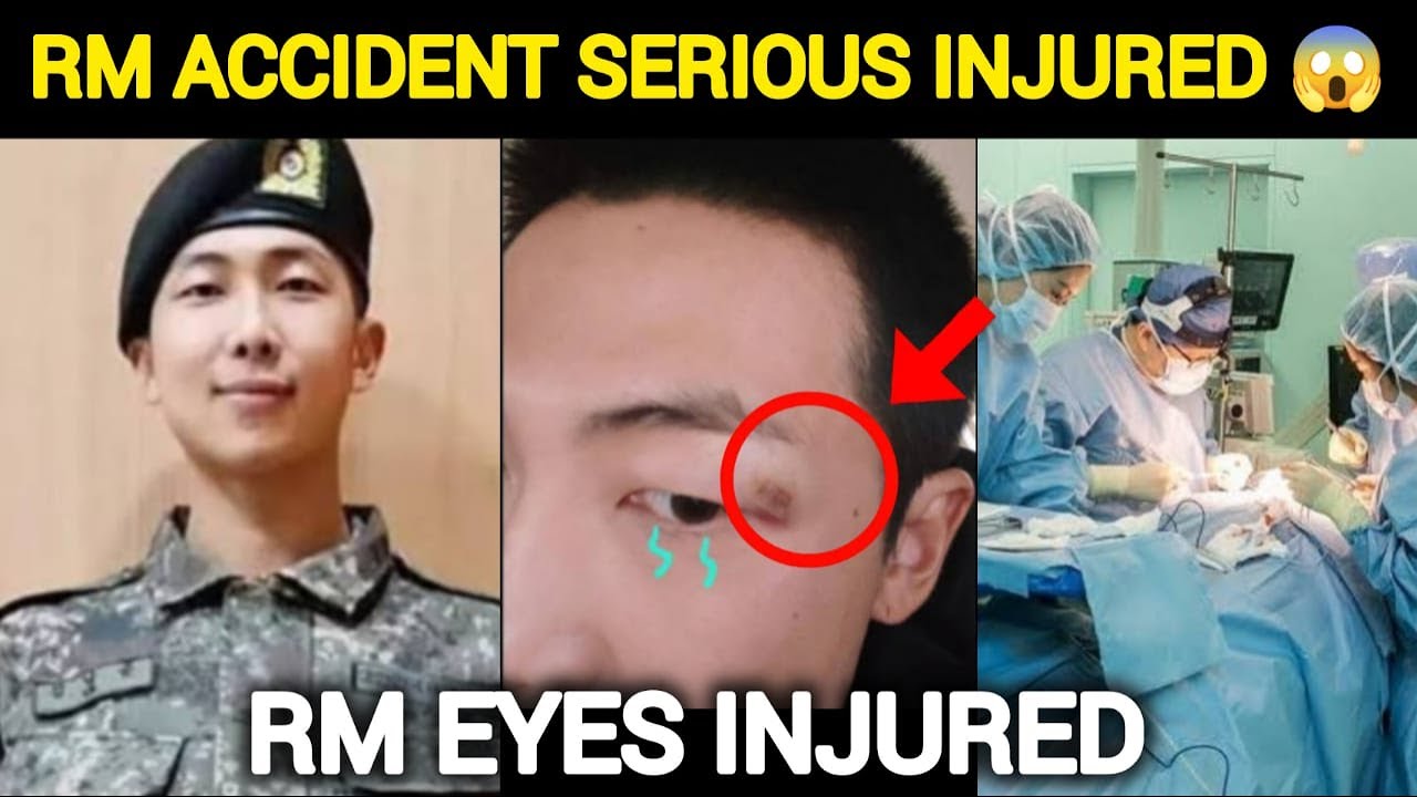 OMG!😳 Rm B@dly injur€d | rm eye injury | bts millitary service#jungkook ...