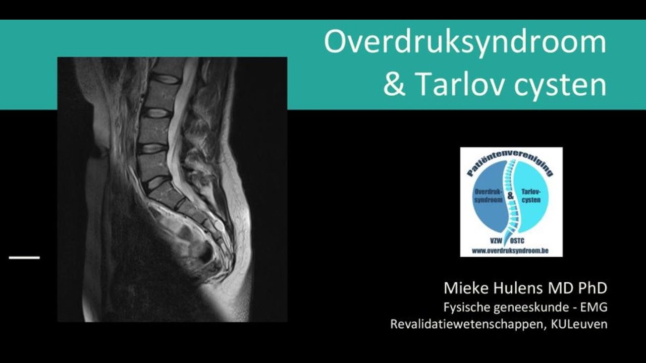 Lezing Tarlov cysten & Overdruksyndroom Dr. Mieke Hulens MD PhD - YouTube