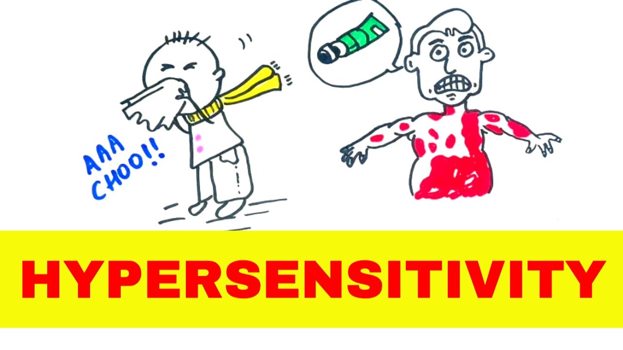 Hypersensitivity | Part 1 - Introduction - YouTube