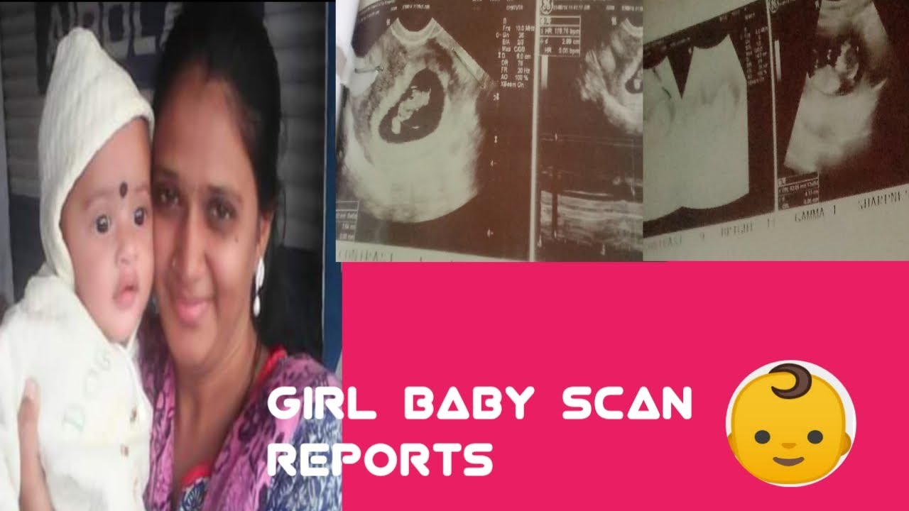 My baby girl complete tiffa scan reports | heart rate| Baby ultrasound ...