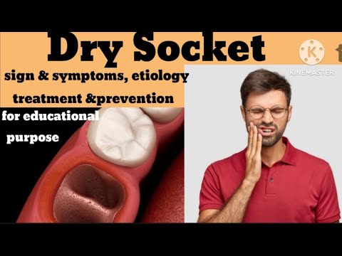 Dry socket| Epidemiology| Sign & Symptoms| Etiology| Treatment ...
