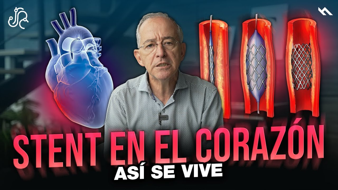 ASÍ Es La VIDA Con Un STENT En El CORAZÓN - Oswaldo Restrepo RSC - YouTube