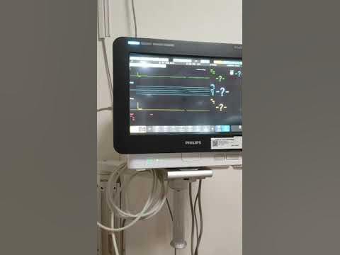 Memasang NIBP dan setting Monitor - YouTube