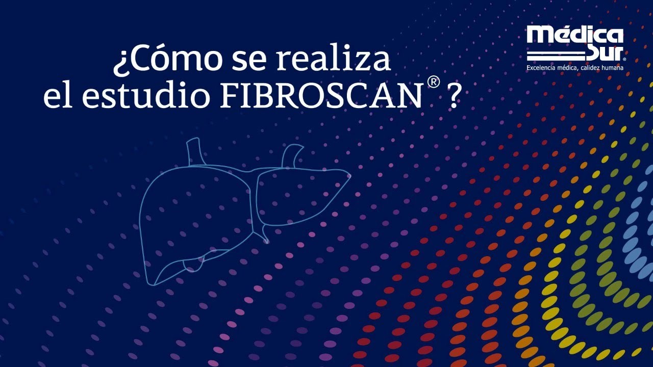 ¿Cómo se realiza el estudio de FibroScan? - Clínica de Hígado Graso de ...