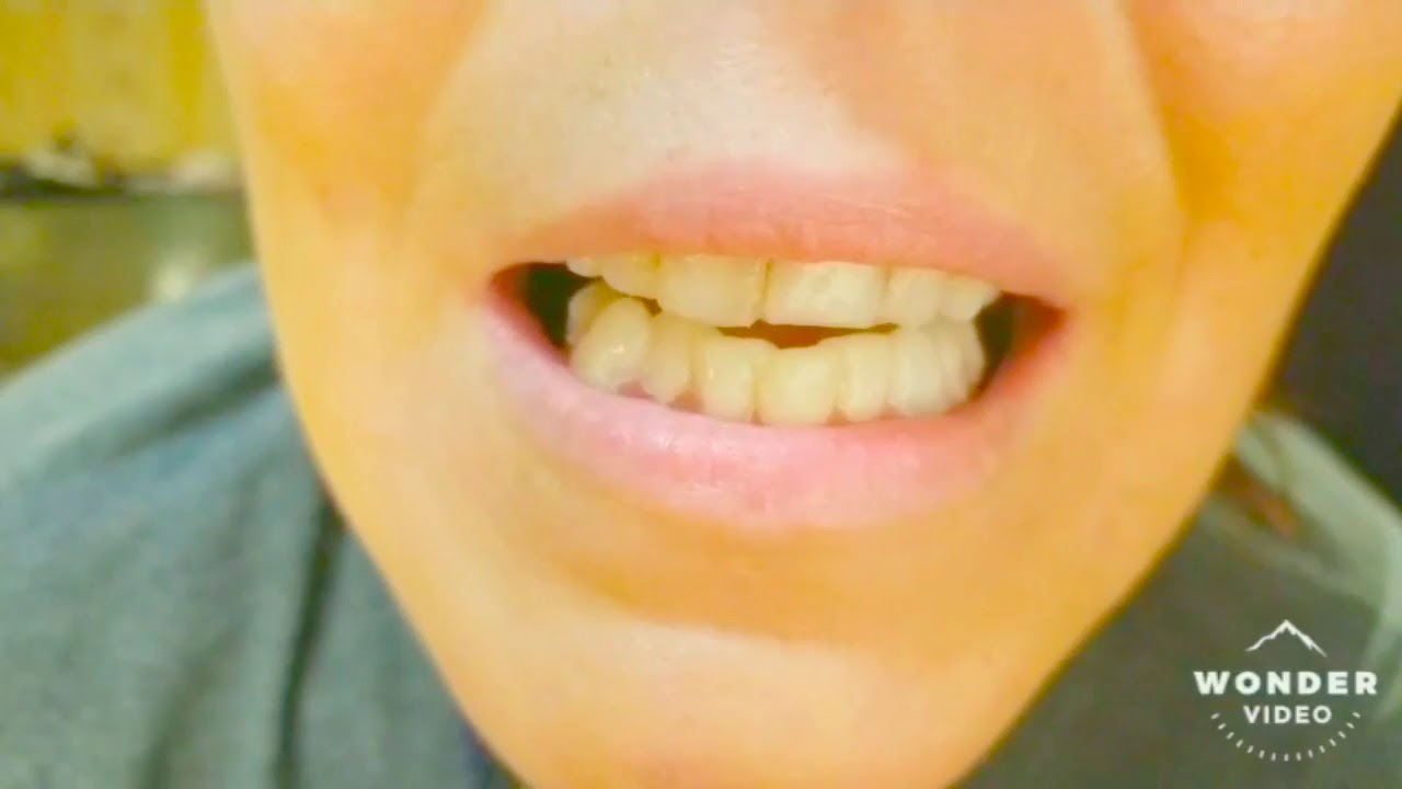 Homemade polymorph teeth covers/cosplay/not dentures. - YouTube