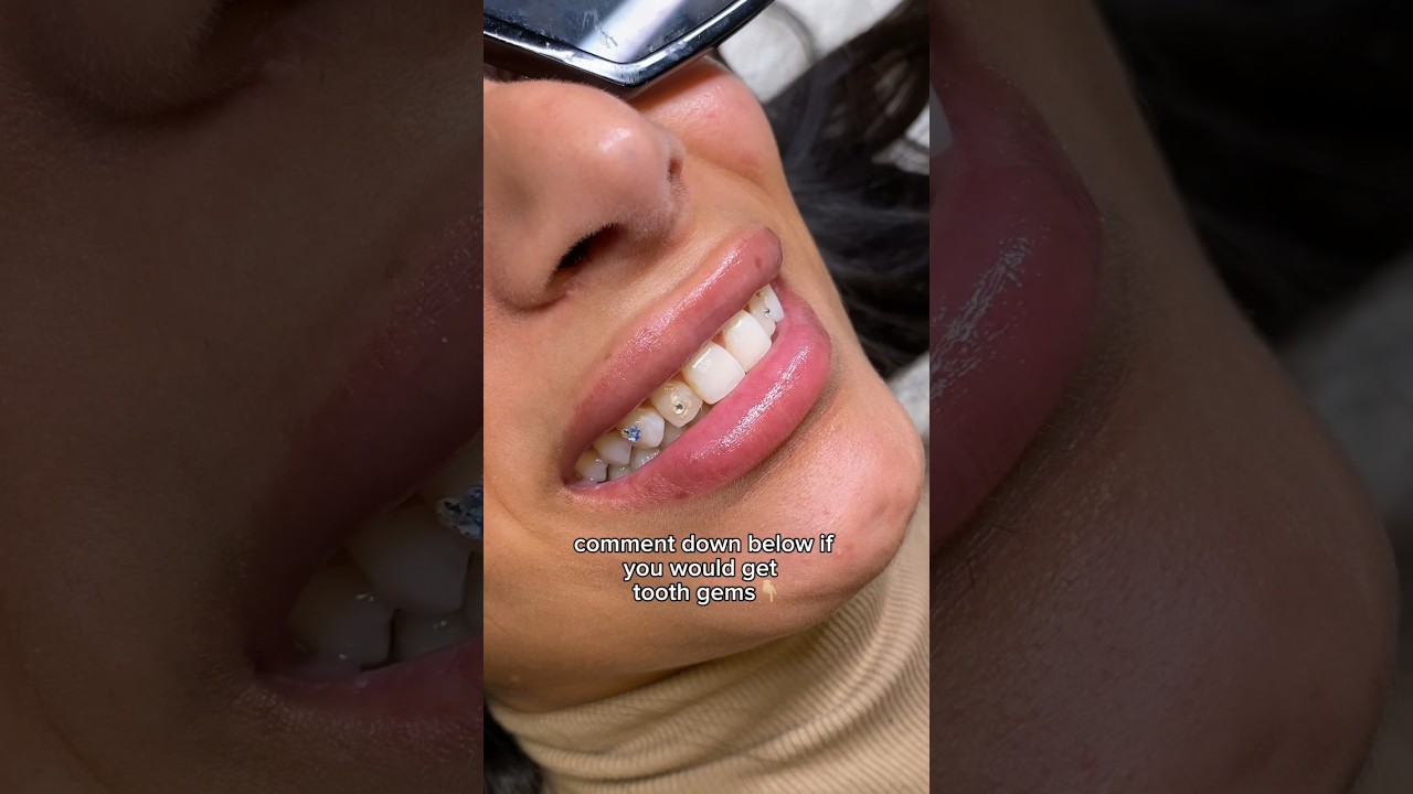 TOOTH GEM APPLICATION💎#toothgems #toothgem #toothgemtechnician # ...