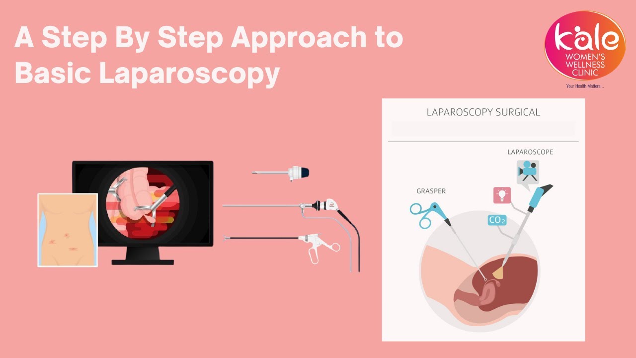 A Step By Step Approach to Basic Laparoscopy - YouTube