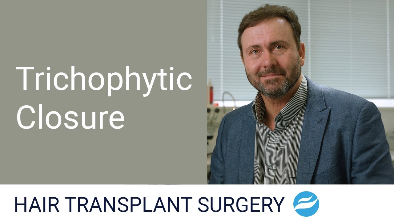 Trichophytic Closure - Dr. André Nel - Hair Restoration Clinic - YouTube