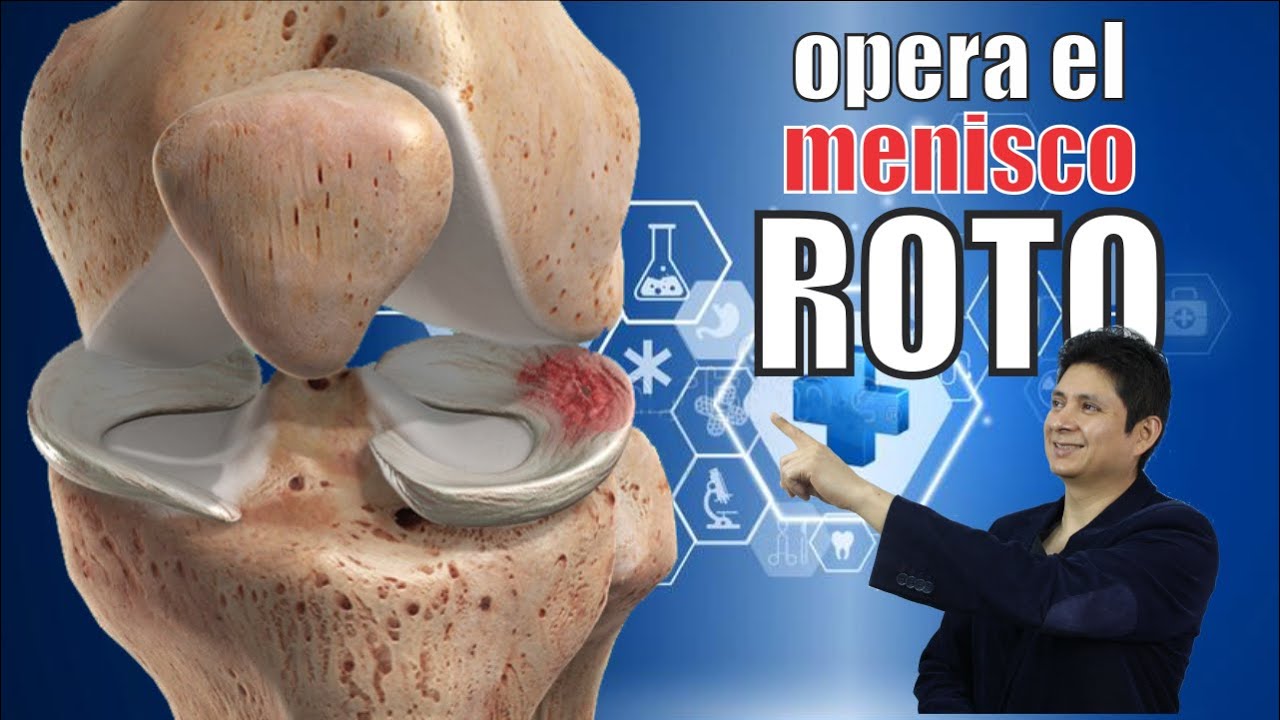 Rotura de MENISCOS 🦵🏼 Cirugía ARTROSCÓPICA de RODILLA ⭐ Dr WALTER ...
