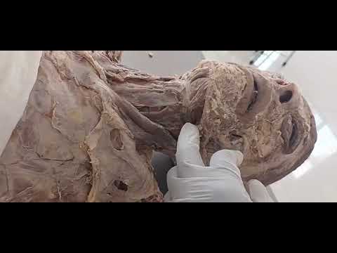 Anterior triangle of Neck Dissection..... by. Dr. Veeramalla. - YouTube