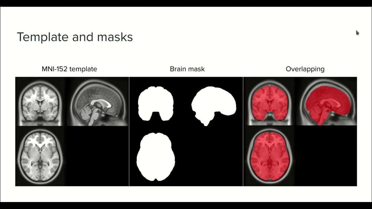 4.0 - MRI Templates and Masks - Course MRI preprocessing with Python ...