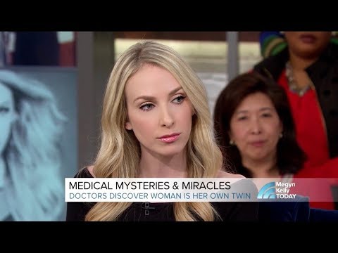 Taylor Muhl- Women Born With Unusual Birthmark Discovers She Is Her Own ...