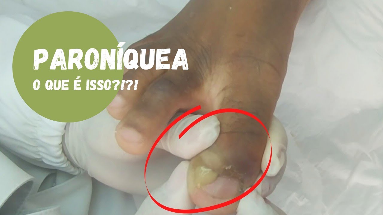 Você sabe o que é PARONÍQUEA? - YouTube