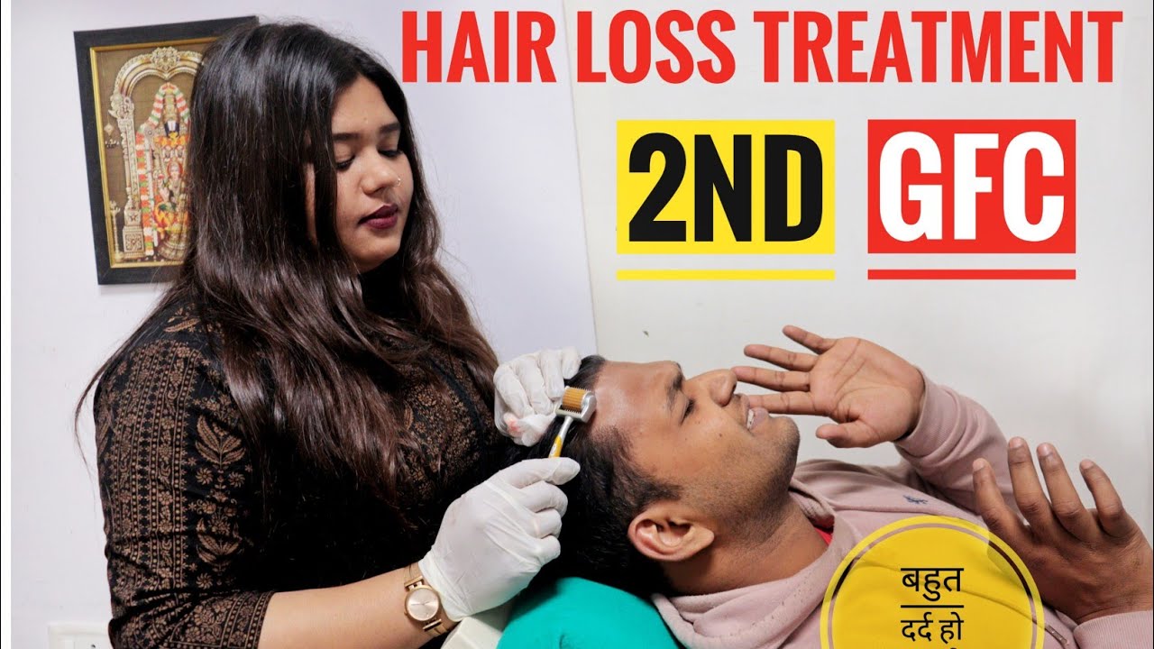 My Second GFC Therapy with Derma Roller - Sonu Kumar Mishra | Hair ...