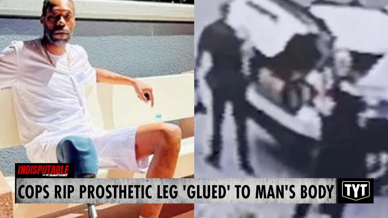 Cops Rip Prosthetic Leg 'Glued' To Man's Body - YouTube