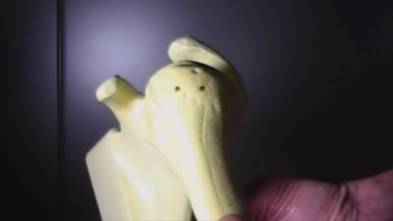 anatomy analgesic position 1 - YouTube